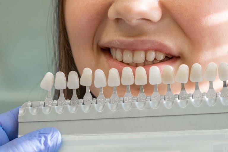 How to Remove Stains from Teeth - Pristine Dentalworks